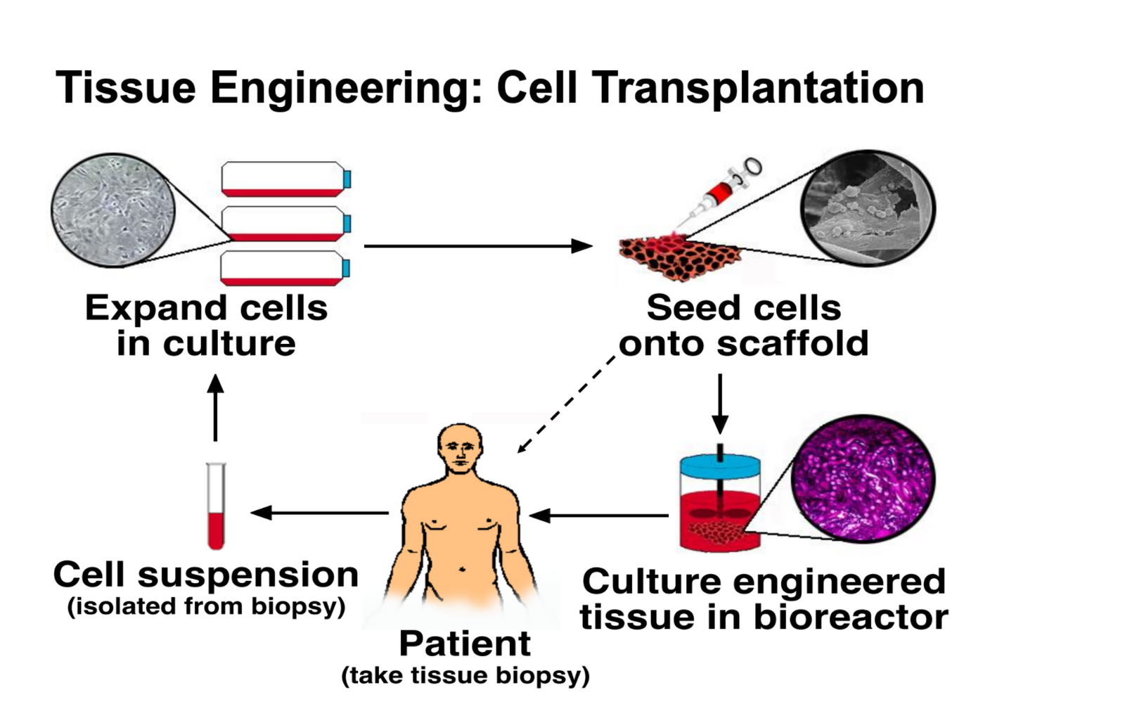 Tissue Engineering Approaches