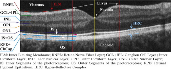 Different retinal layers in OCT
