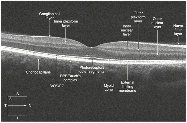 Different retinal layers in OCT